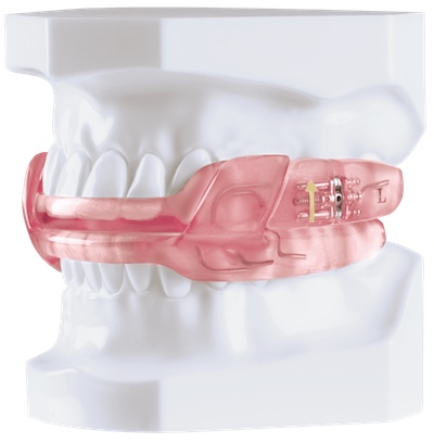 Snoring and Sleep Apnea Appliances | Greenville, TX